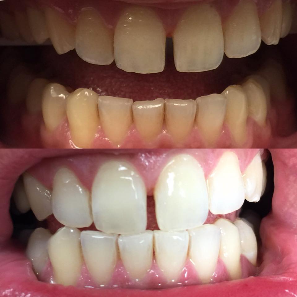 N Charleston WV, Kenneth H. Dolan II, DDS, PLLC